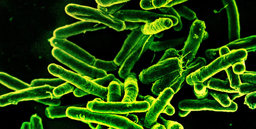 Which Strains of Tuberculosis Are the Most Infectious? | Harvard Medical School